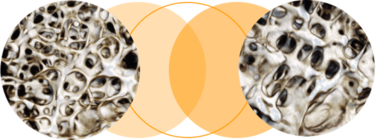 Postmenopausal Osteoporosis Treatment | EVENITY® (romosozumab-aqqg)