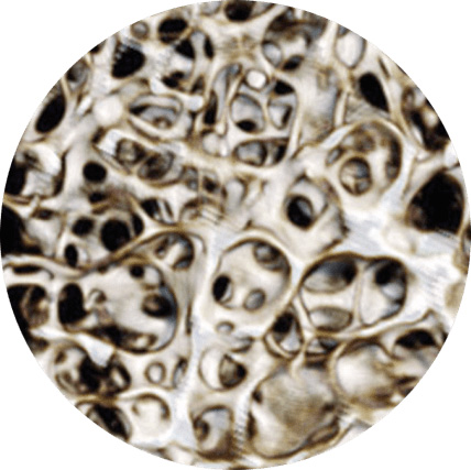 Postmenopausal Osteoporosis Treatment | EVENITY® (romosozumab-aqqg)